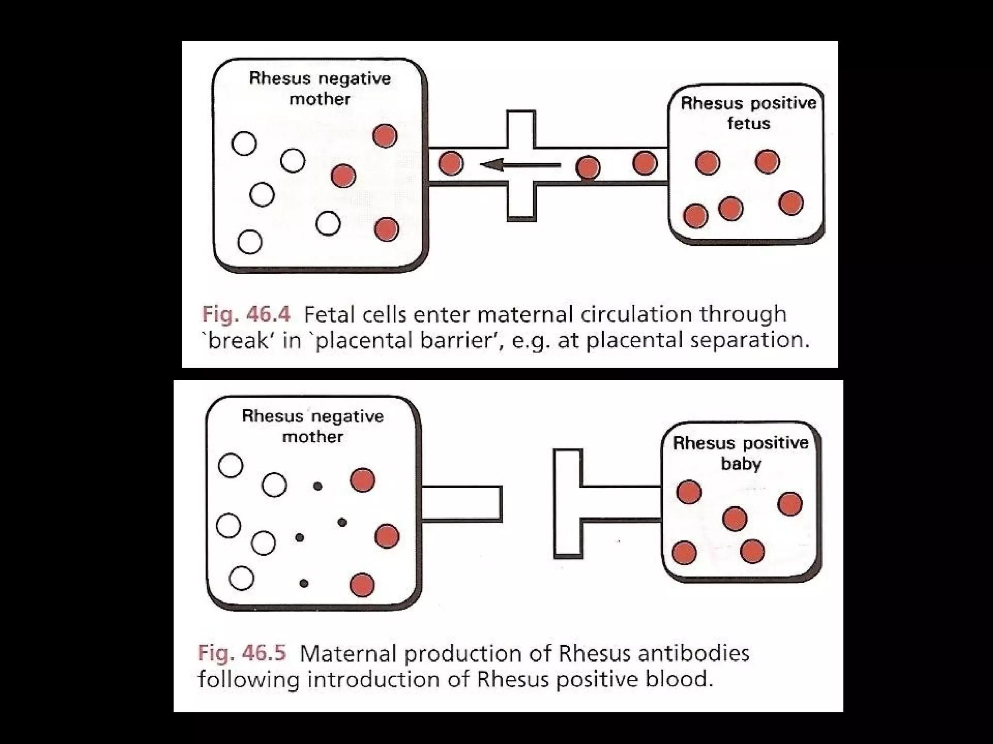 fetal circulation & Rh incompatibility | PPT