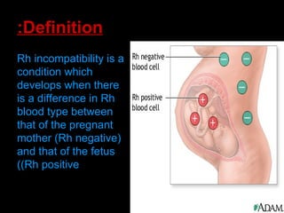 fetal circulation & Rh incompatibility | PPT