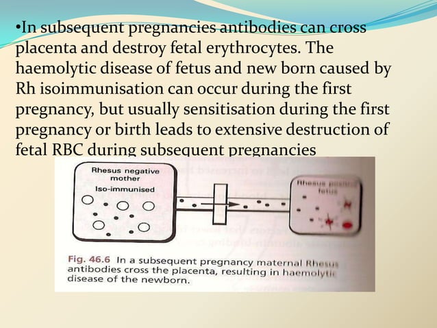 Rh incompatibility | PPTX