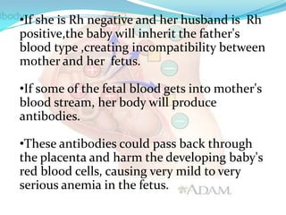 Rh incompatibility | PPTX