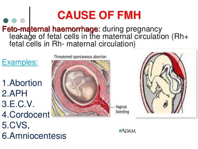 Rh isoimmunization