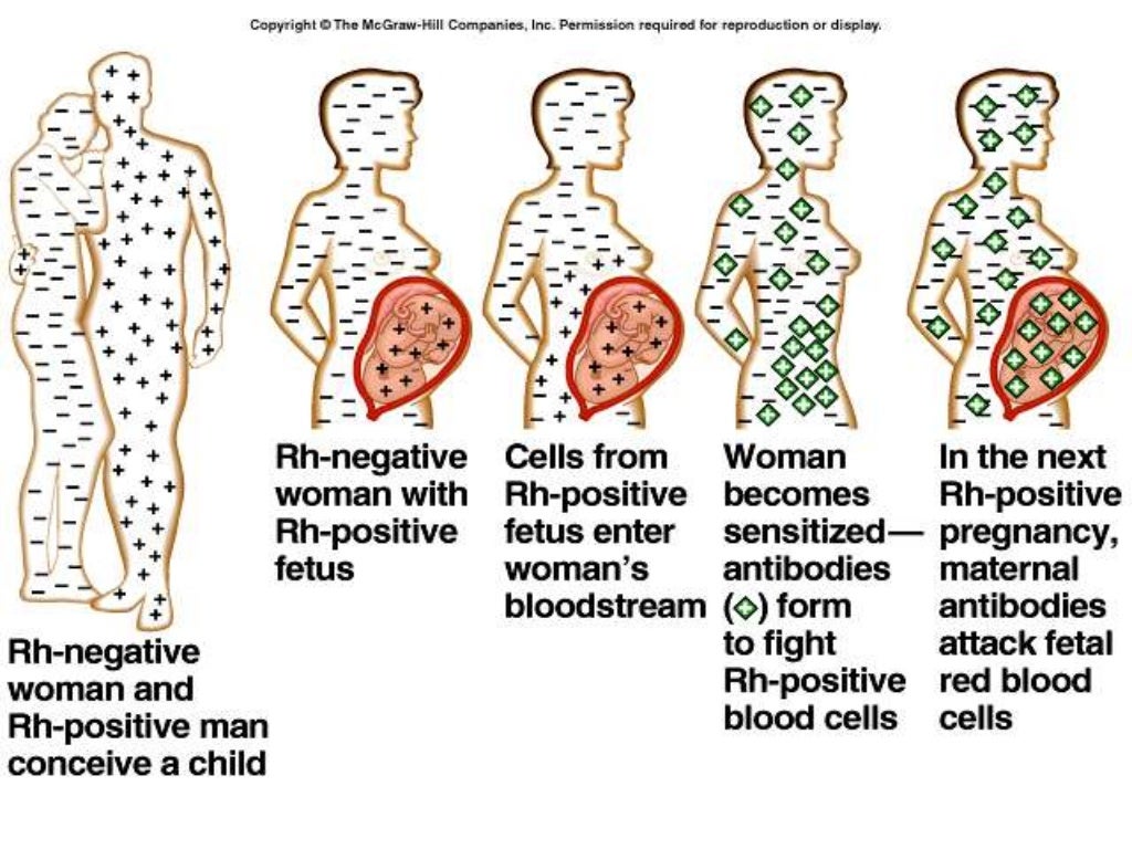 Rh isoimmunization
