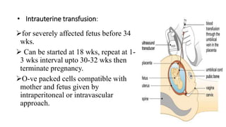 Rh iso immunization | PPTX