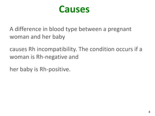 Rh negative disease | PPTX