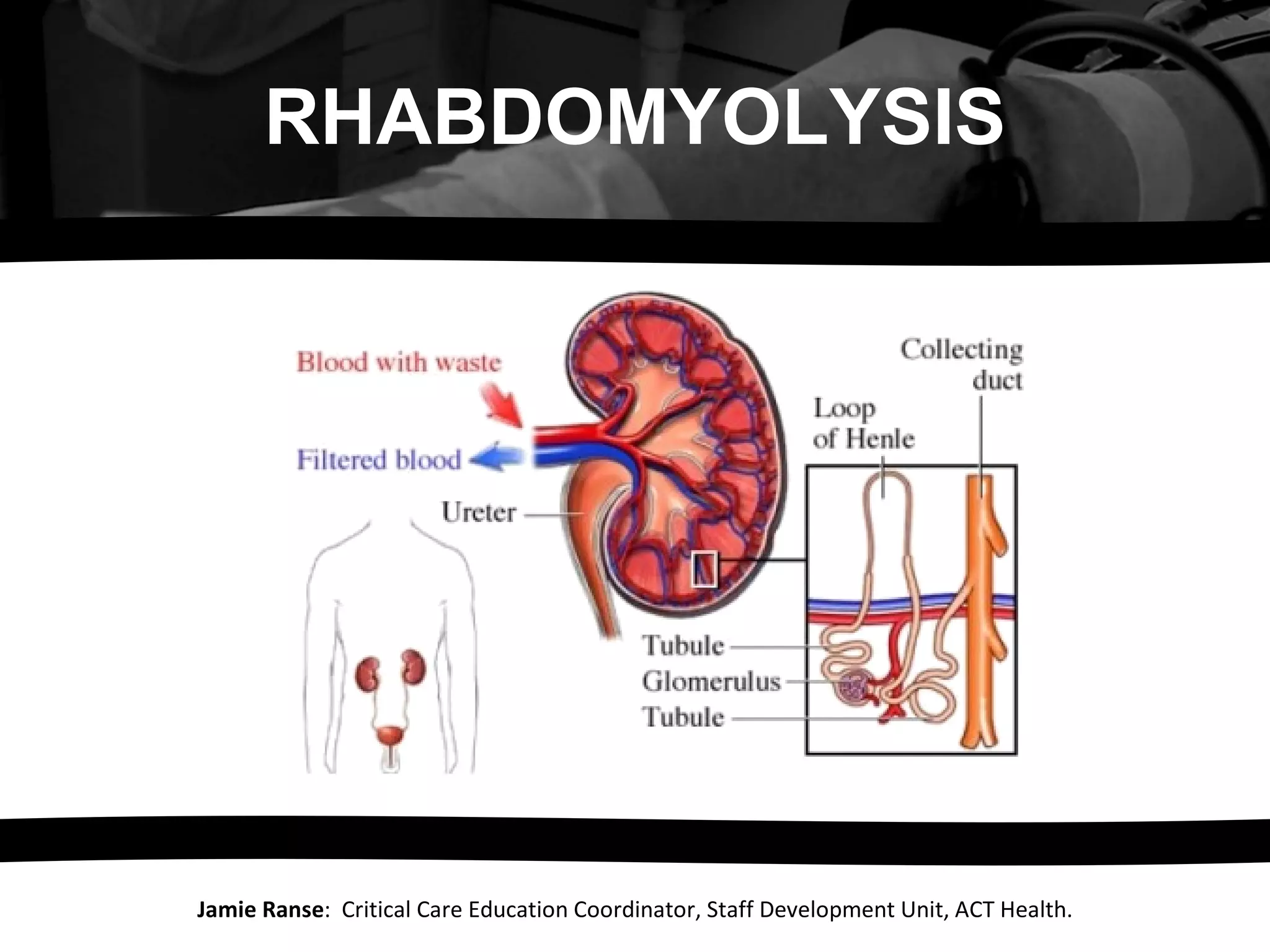 Rhabdomyolysis | PPT