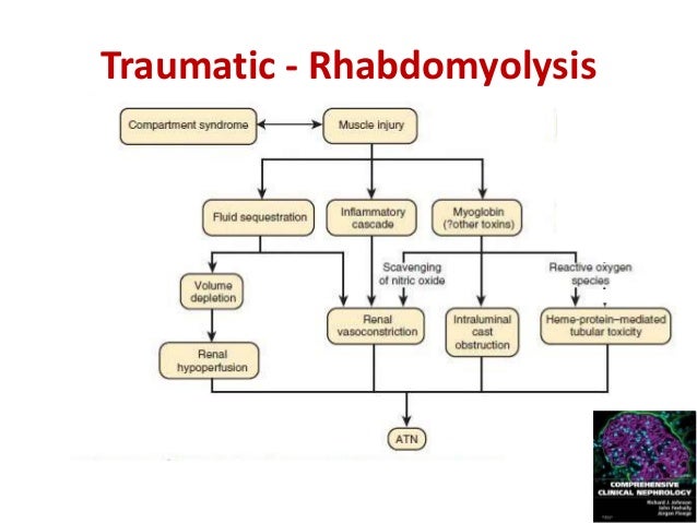 Rhabdomyolysis - Form Pathogenesis to Bedside