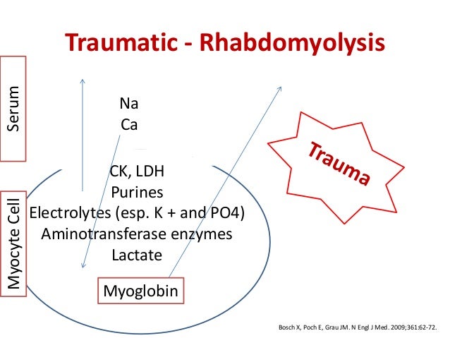 Rhabdomyolysis - Form Pathogenesis to Bedside