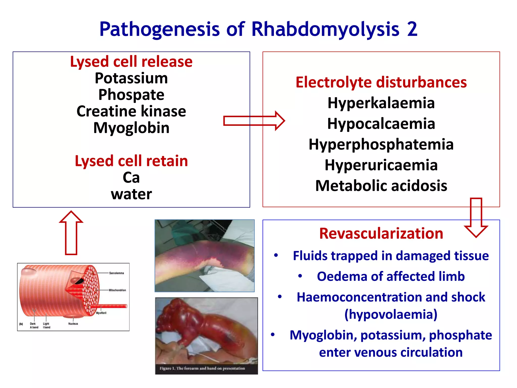 Rhabdomyolysis | PPTX