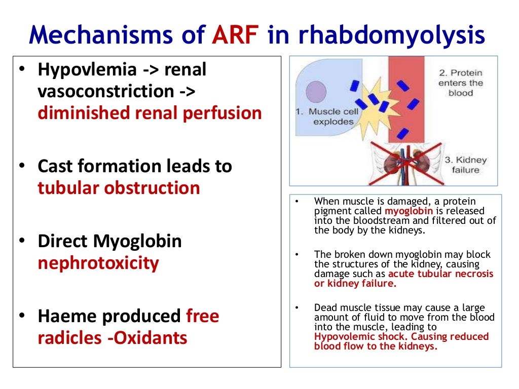 Rhabdomyolysis