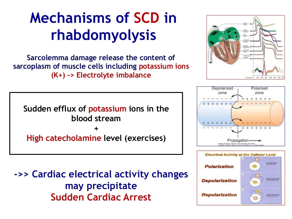 Rhabdomyolysis