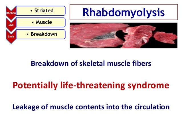 Rhabdomyolysis