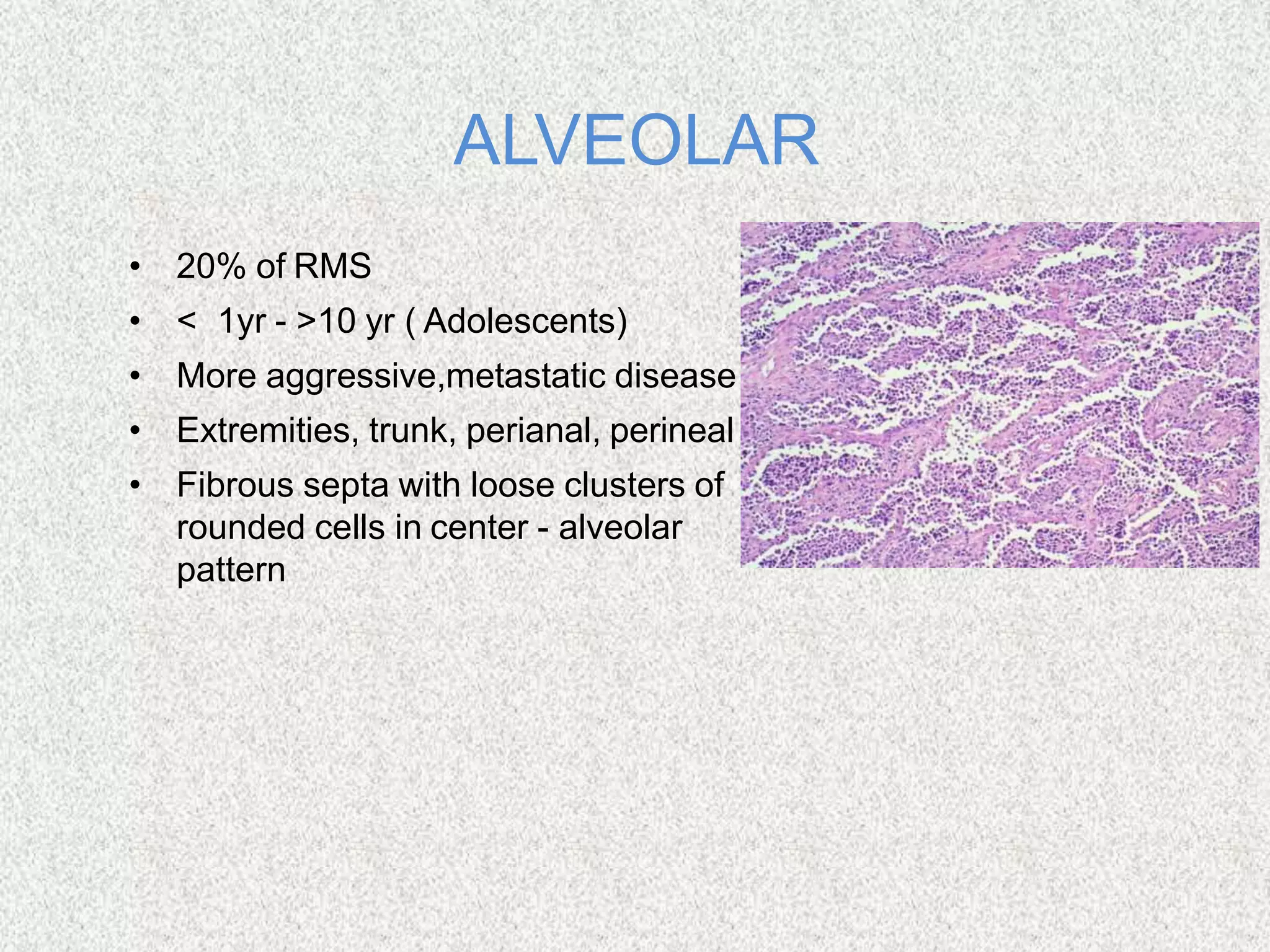 Rhabdomyosarcoma.pptx