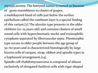 Rhabdomyosarcoma ; rare case report | PPT