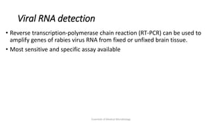 Rhabdo Viruses (Rabies virus) | PPT