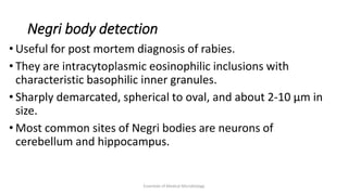 Rhabdo Viruses (Rabies virus) | PPT