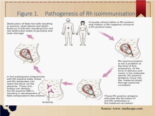Rh antigens and its role in alloimmunization in pegnancy..ppt