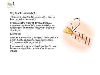 ANATOMICAL SUFFIXES RHAPHY & SCOPE | PDF