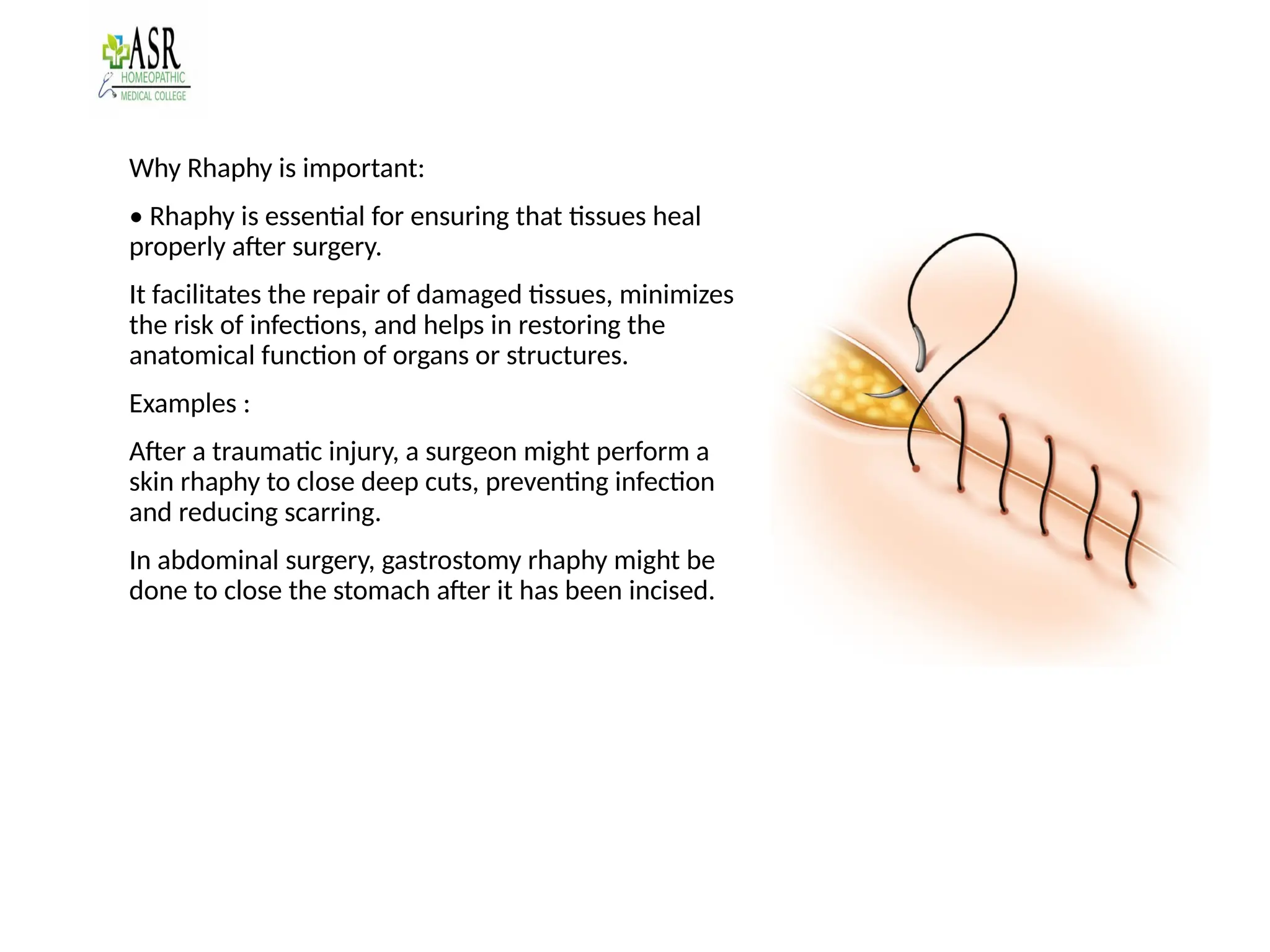 ANATOMICAL SUFFIXES RHAPHY & SCOPE | PPTX