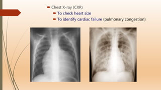 Rheumatic heart disease (Modern Vs Ayurveda) | PPTX