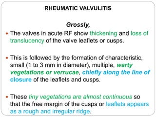 Rheumatic heart disease and their features.pptx