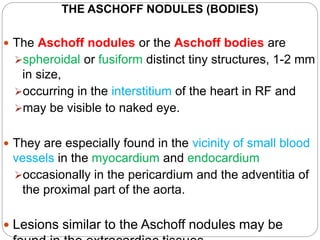 Rheumatic heart disease and their features.pptx