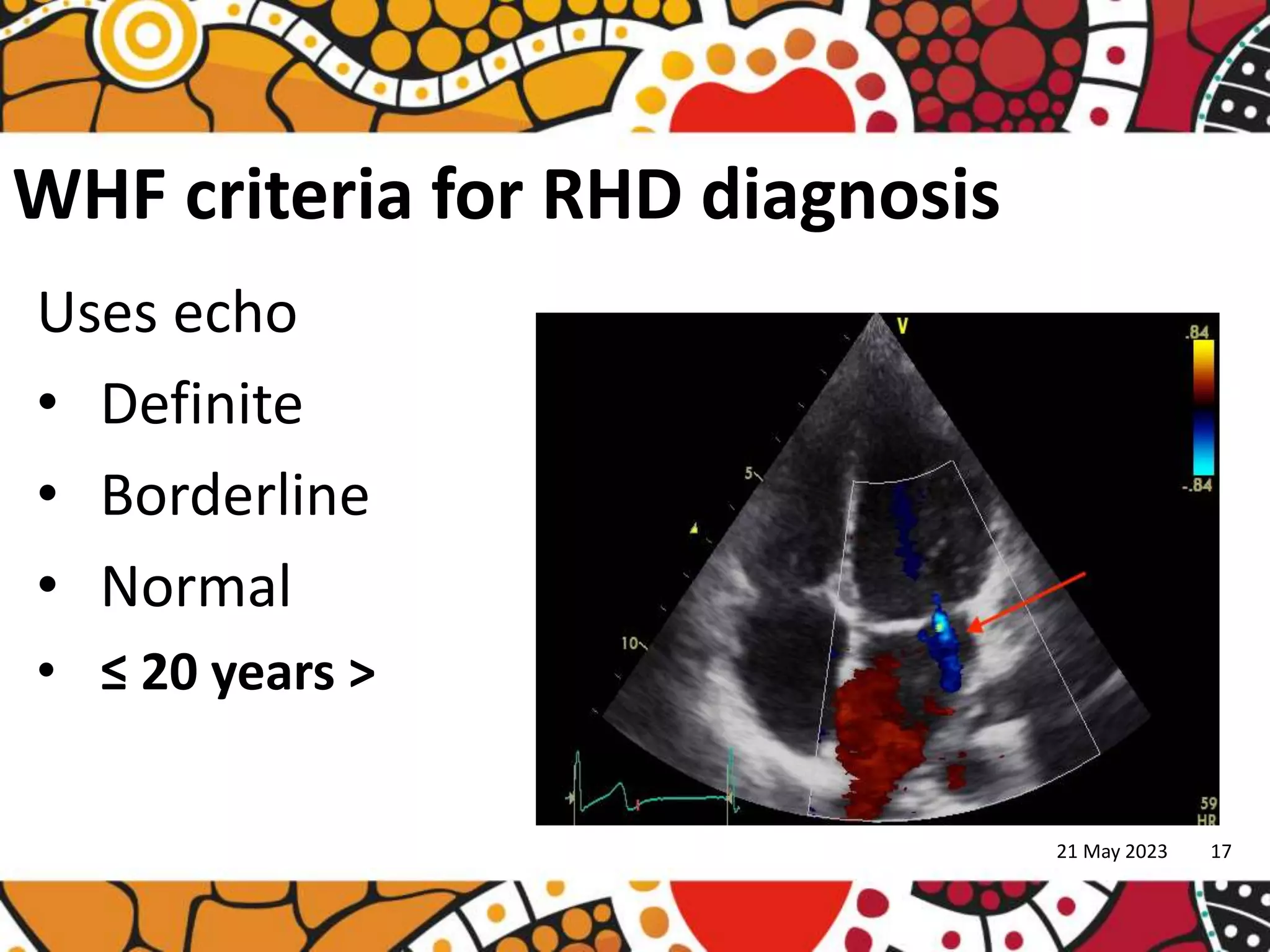 rhd_diagnosis_management.pptx