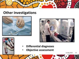 rhd_diagnosis_management.pptx
