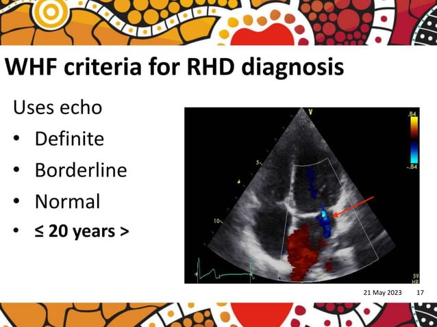 rhd_diagnosis_management.pptx