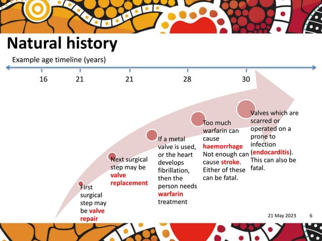 rhd_diagnosis_management.pptx