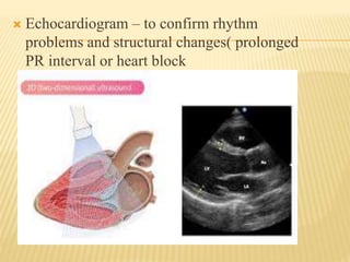 Rhd ppt BY VAISHALI | PPTX
