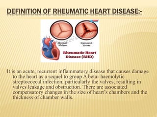 Rhd ppt BY VAISHALI | PPT