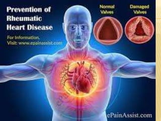 Rhd ppt BY VAISHALI | PPTX