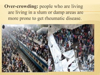 Rhd ppt BY VAISHALI | PPTX