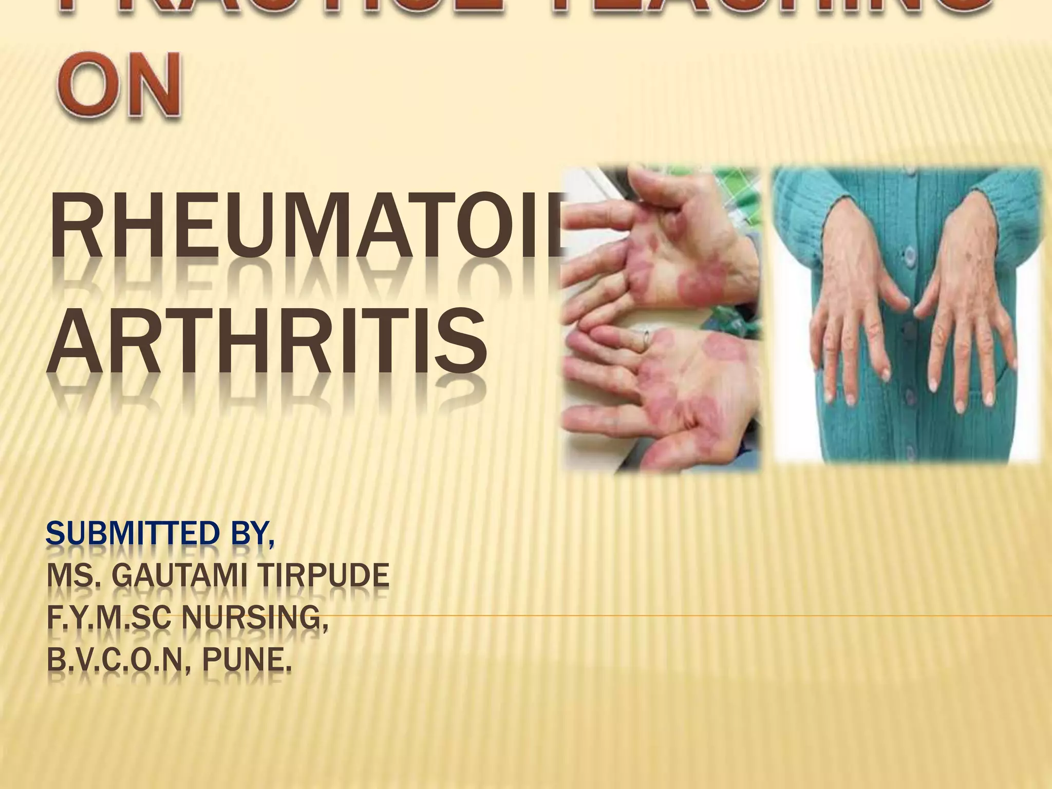 Rhematoid arthritis uploaded | PPTX