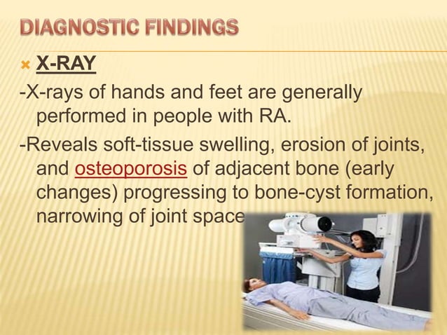Rhematoid Arthritis Uploaded Ppt