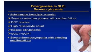 Rhematoligical Emergency Systemic Lupus Erythrometosis.pptx
