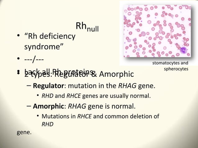 Rhesus | PPT | Blood Disorders | Diseases and Conditions
