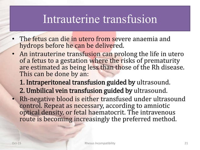 Rhesus incompatibility | PPTX