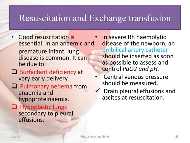Rhesus incompatibility | PPTX