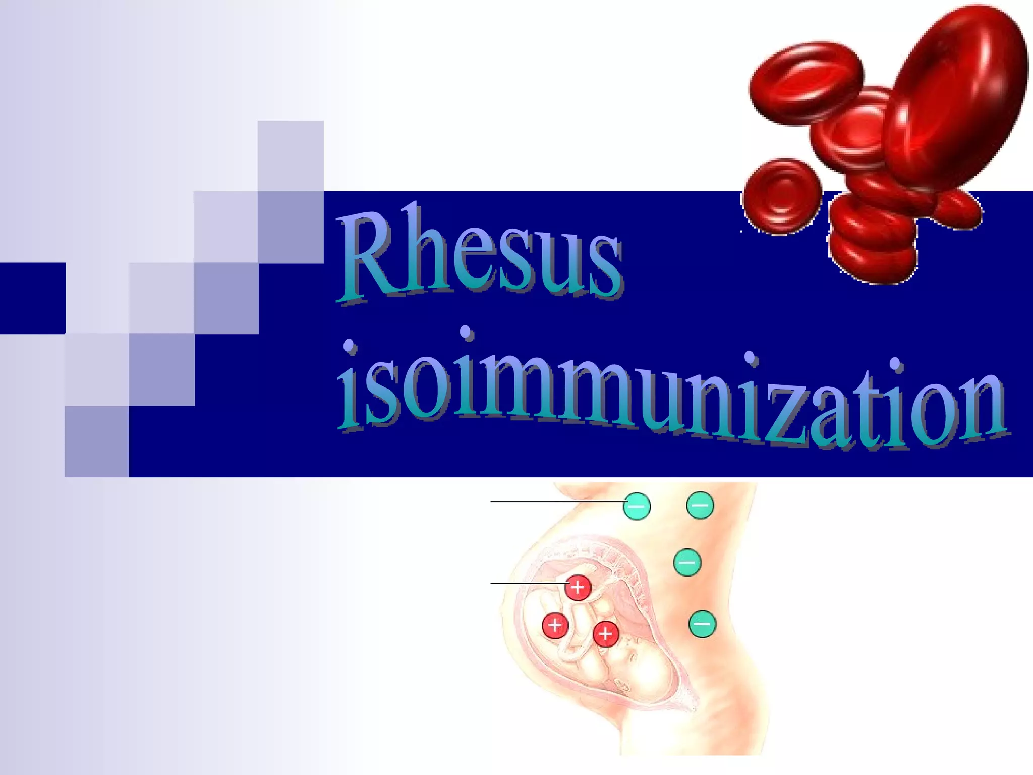 Rhesus Isoimmunisation | PPT