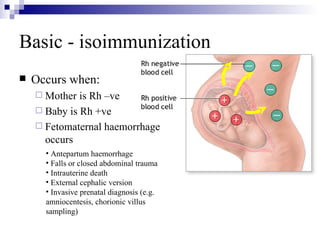 Rhesus Isoimmunisation | PPT