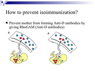 Rhesus Isoimmunisation | PPT