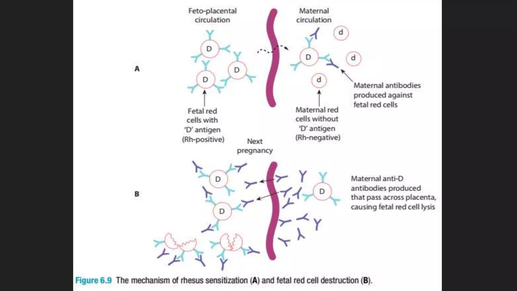 RHESUS ISOIMMUNIZATION.pptx