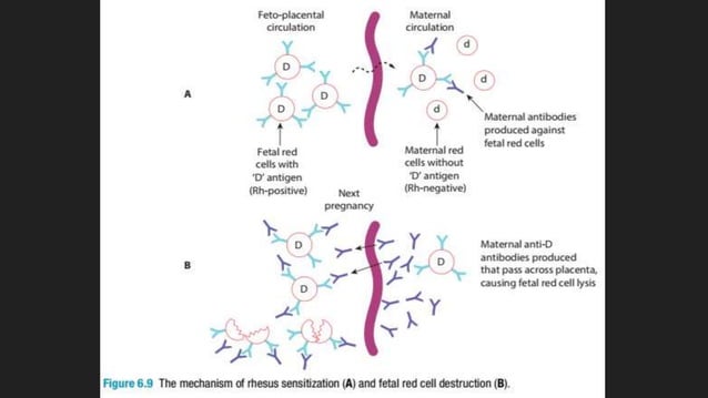 RHESUS ISOIMMUNIZATION.pptx