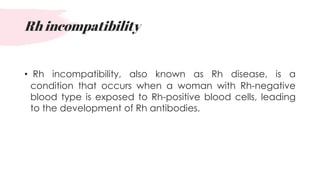 RHESUS NEGATIVE IN PREGNANCY .pptx