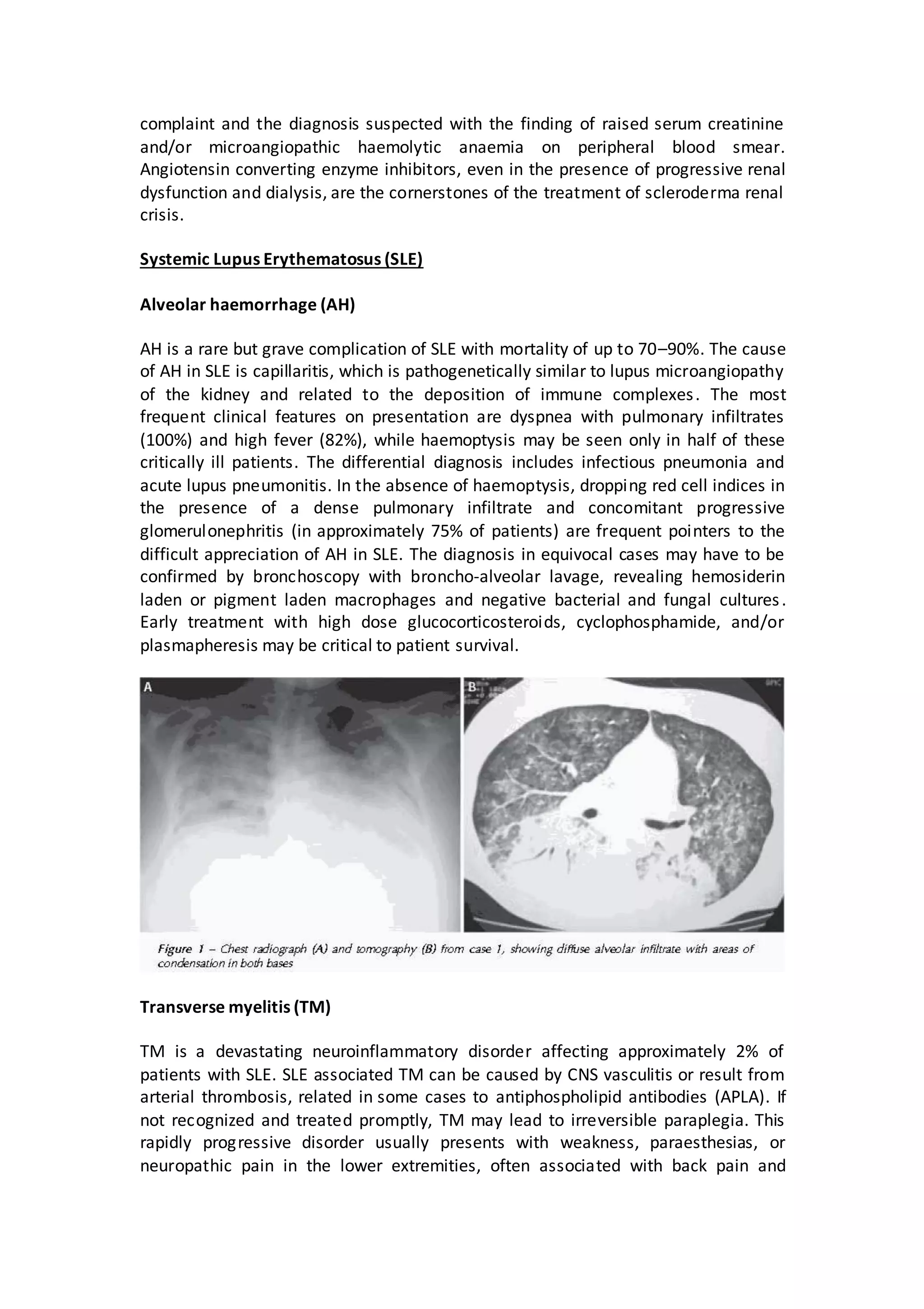 Rheumatological Emergencies | DOCX