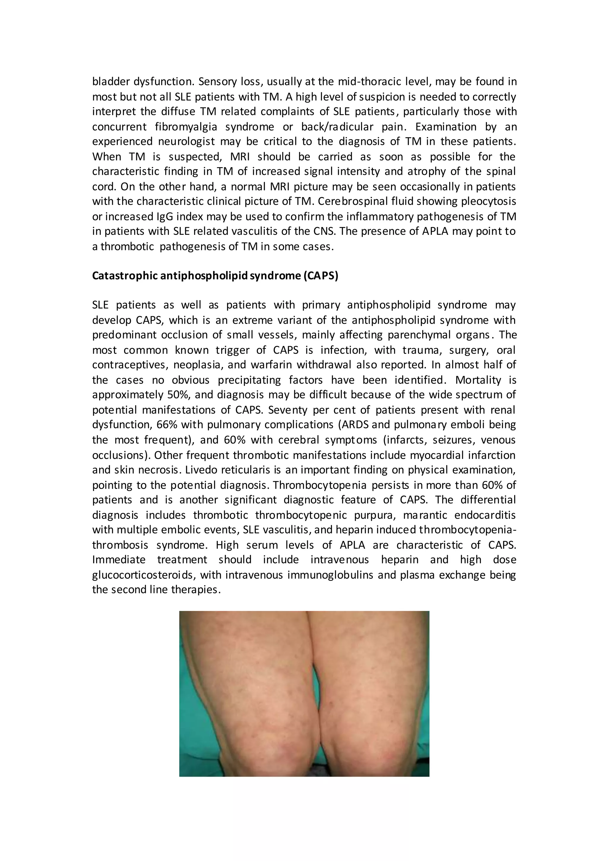 Rheumatological Emergencies | DOCX