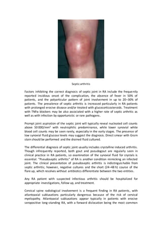 Rheumatological Emergencies | DOCX