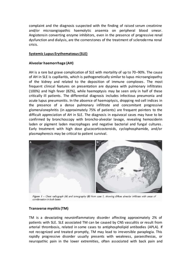 Rheumatological Emergencies | DOCX | Physical Therapy | Wellness