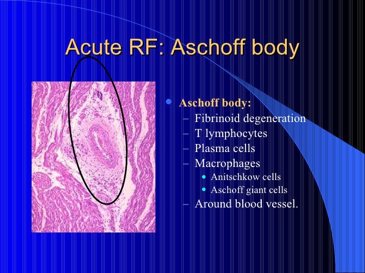 RHEUMATIC HEART DISEASE BY DR BASHIR AHMED DAR ASSOCIATE PROFESSOR ME…